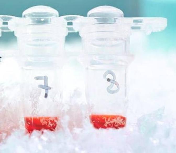 Calcium Assay | Articles | bioscience | Gan Jing World